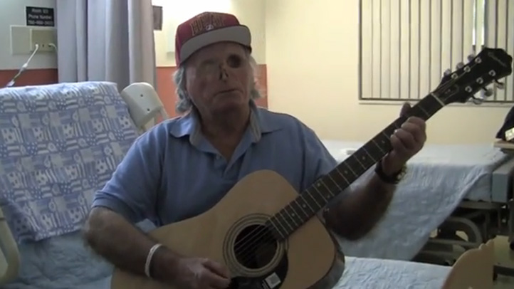 Ronald Poppo, Miami Face Mauling Victim, Releases Video Message – NBC ...