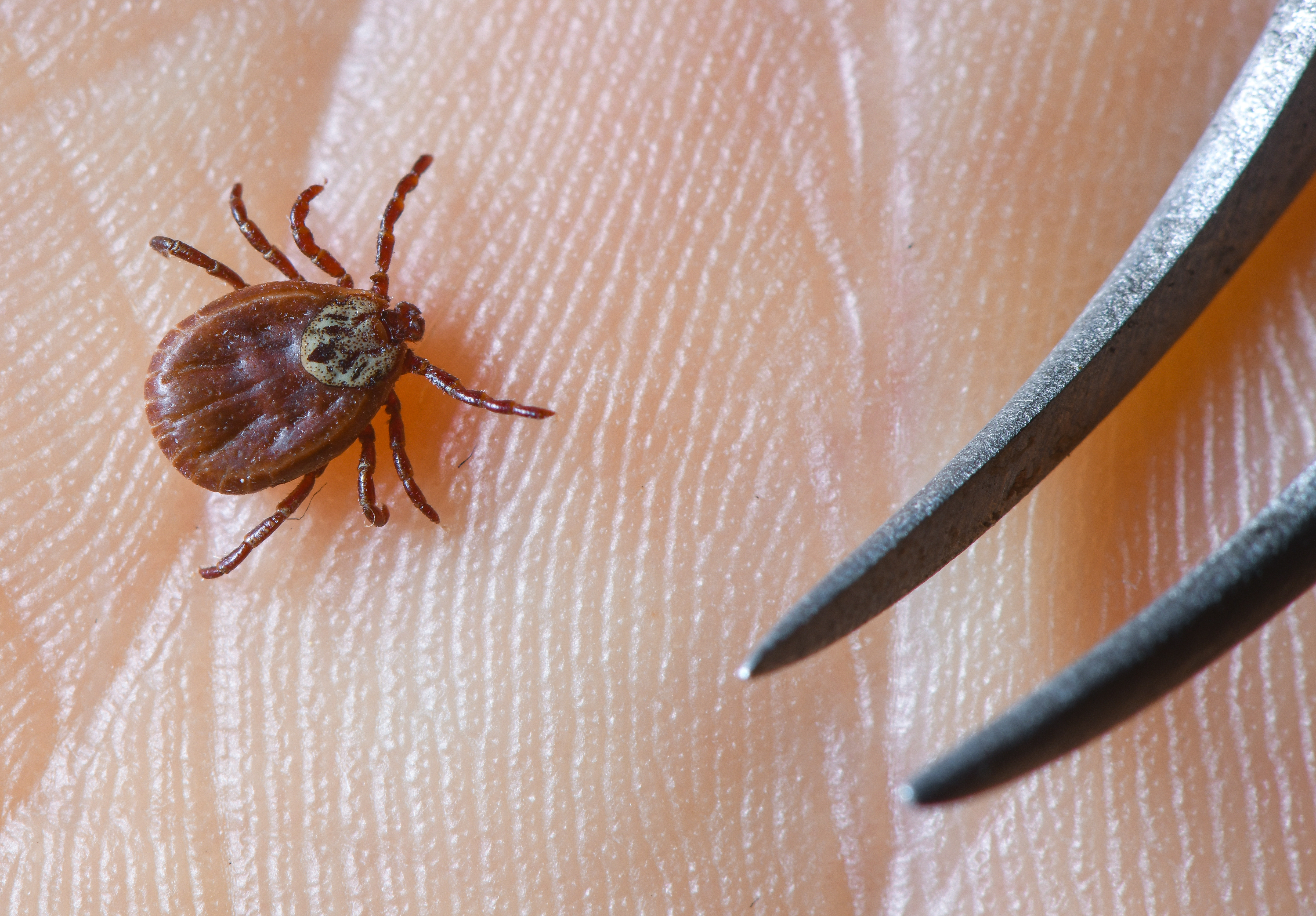 Tick-borne illnesses may be on the rise because of climate change – NBC ...
