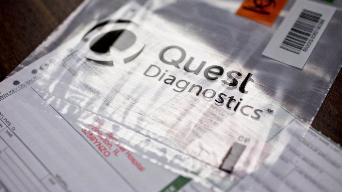 FDA Approves Quest COVID-19 Test for ‘pooled’ Sample Use – NBC New York