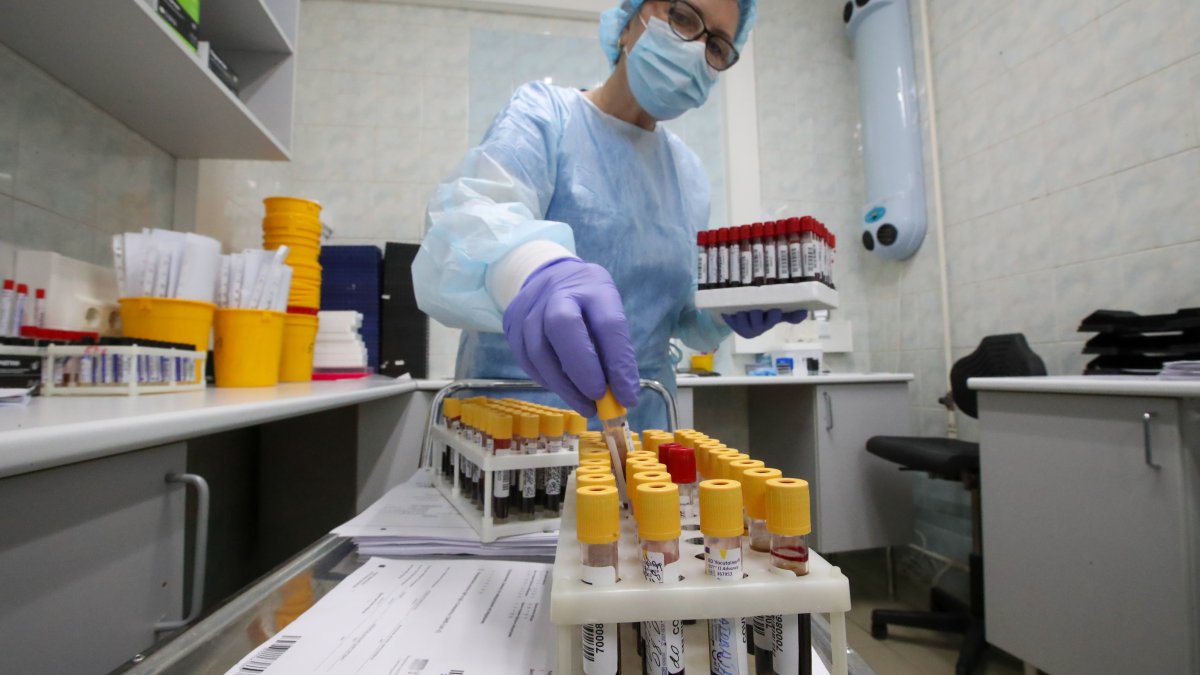 Roche’s Coronavirus Antibody Test Gets Emergency Use Authorization From ...