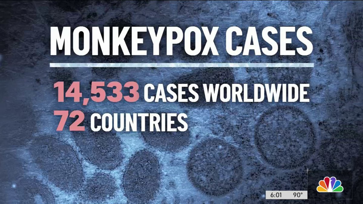 Monkeypox Declared a Global Health Emergency – NBC New York