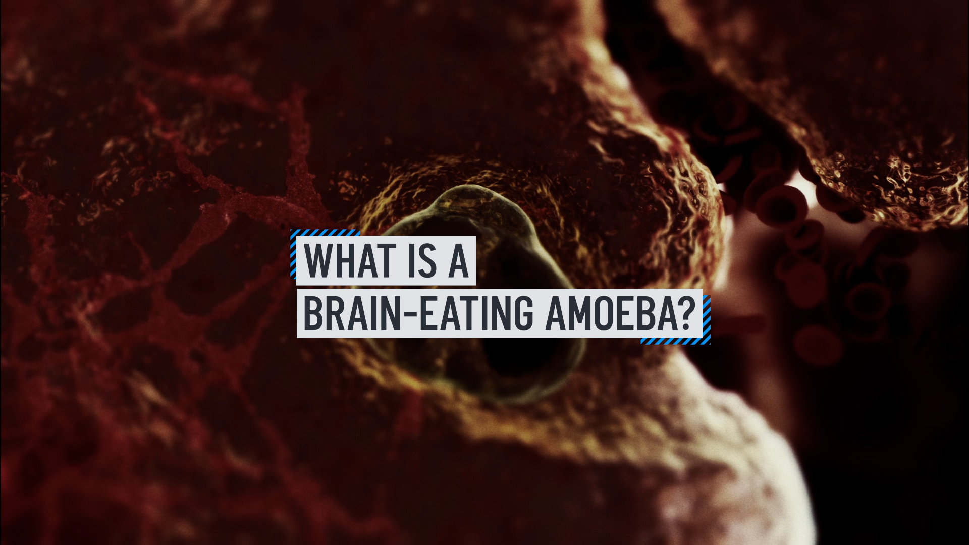 What is a Brain-Eating Amoeba? – NBC New York