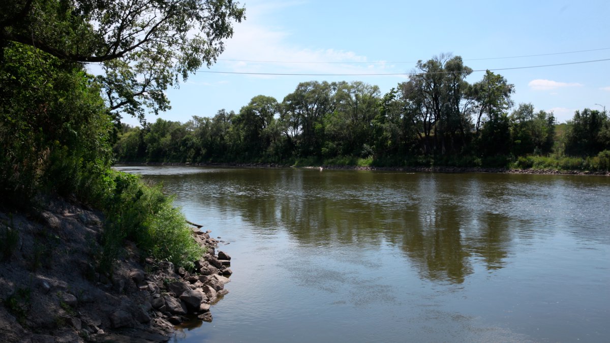 Child Dies From Suspected Case of Brain-Eating Amoeba Infection in ...