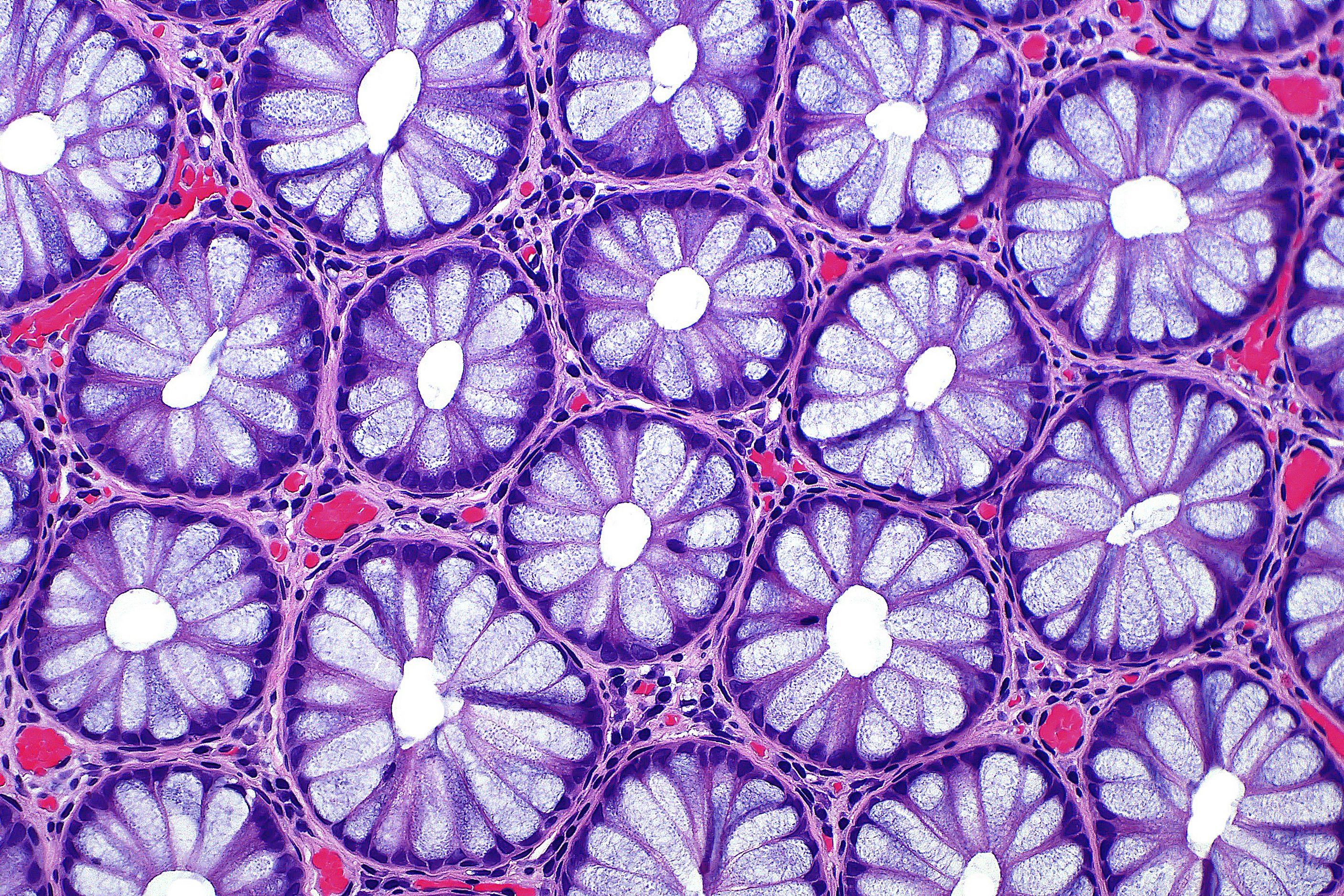 Photos Capture World of Microscopic Wonders – NBC New York