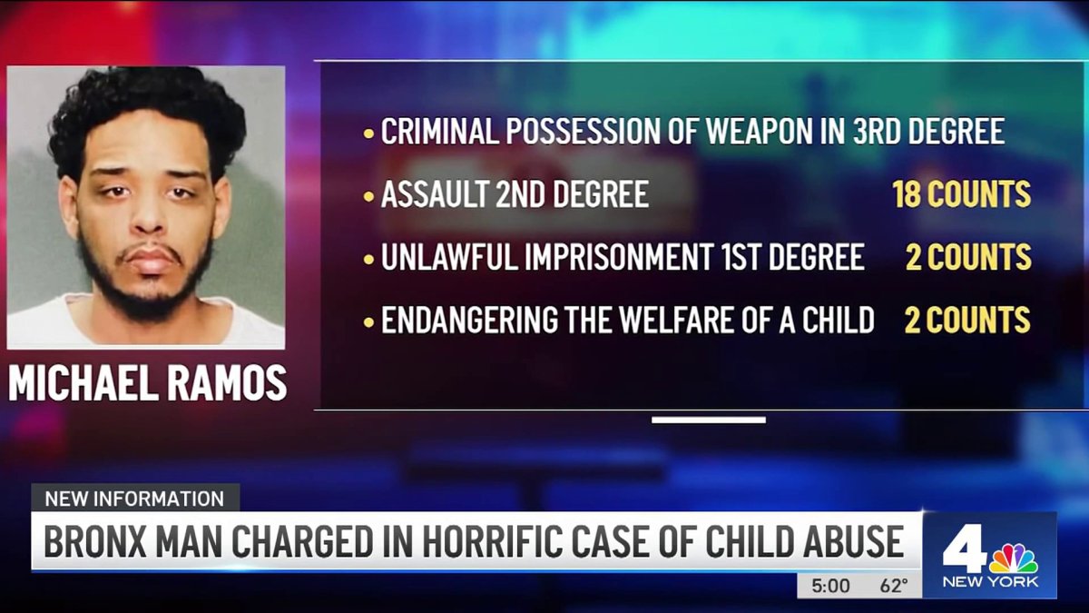 Bronx Man Charged in Horrific Case of Child Abuse – NBC New York