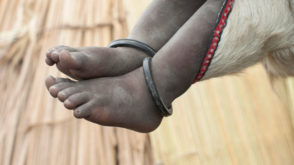 300 children rescued after 71 died in a Sudanese orphanage – NBC New York