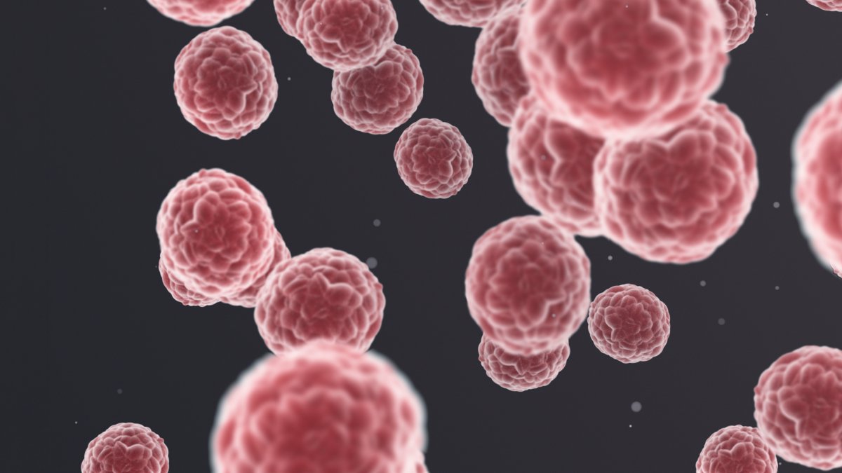 What is Merkel cell carcinoma? The skin cancer that killed Jimmy ...