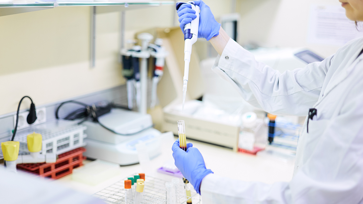 A blood test for long Covid is possible, a study suggests – NBC New York