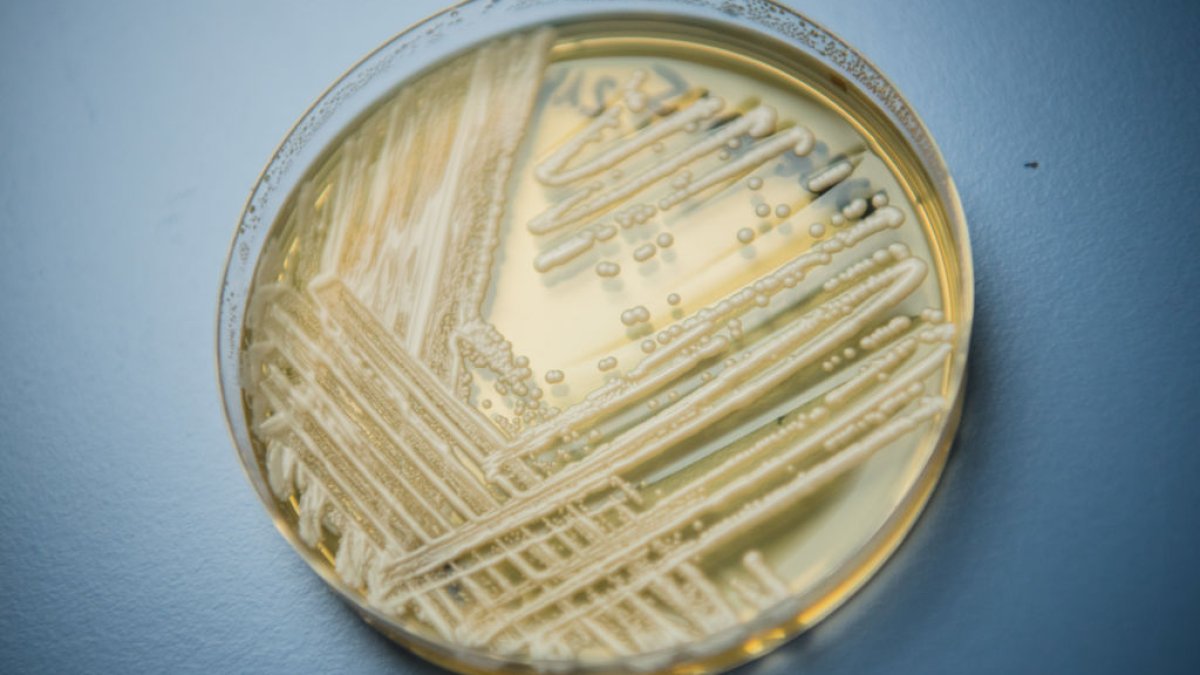 Washington state faces first outbreak of a deadly fungal infection that ...