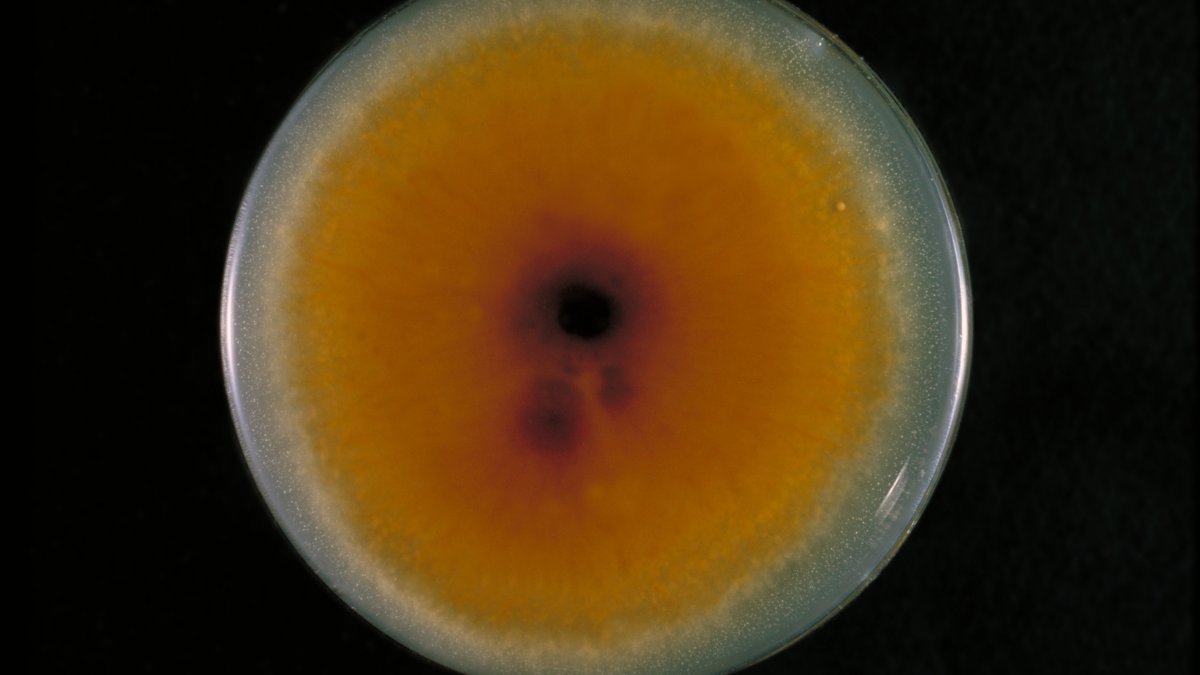 First case of rare, sexually transmitted form of ringworm reported in ...