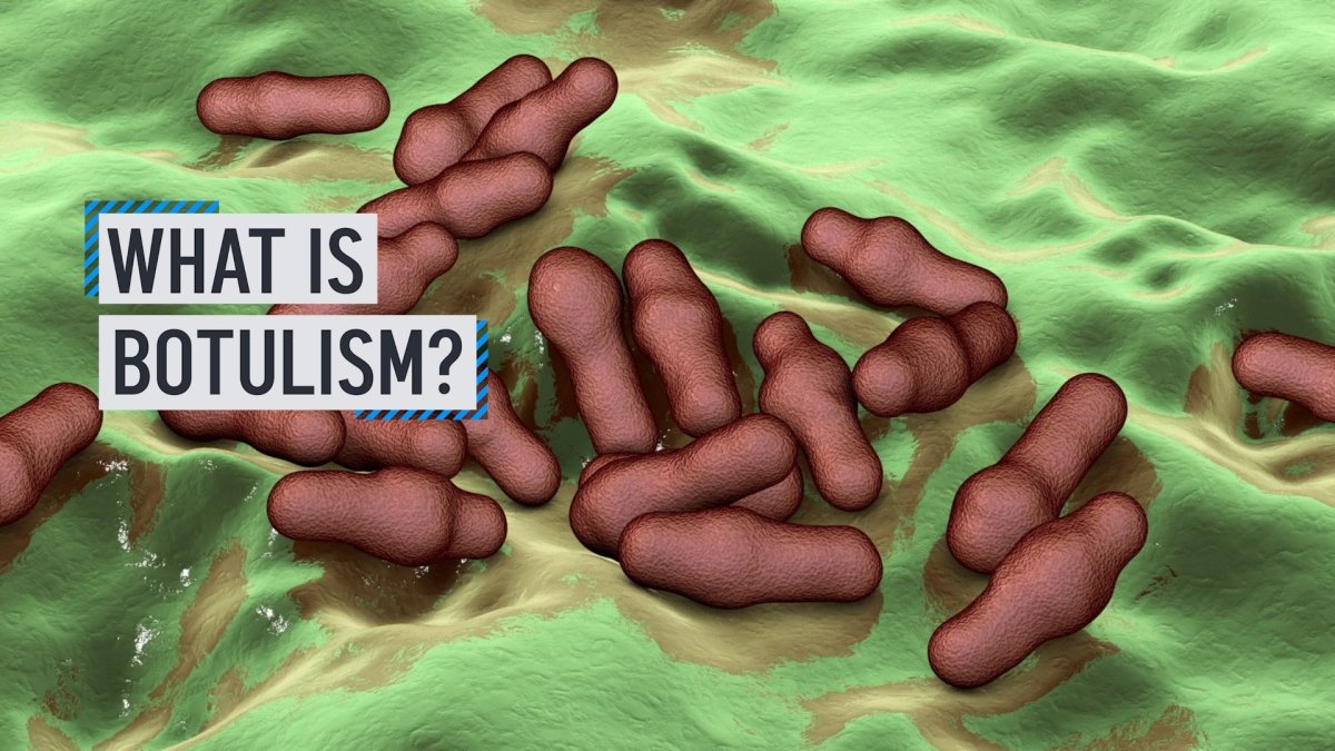 What is botulism? – NBC New York
