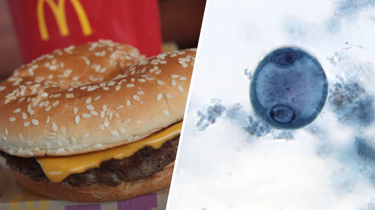 E. coli outbreak linked to McDonald’s Quarter Pounders: What to know – NBC New York