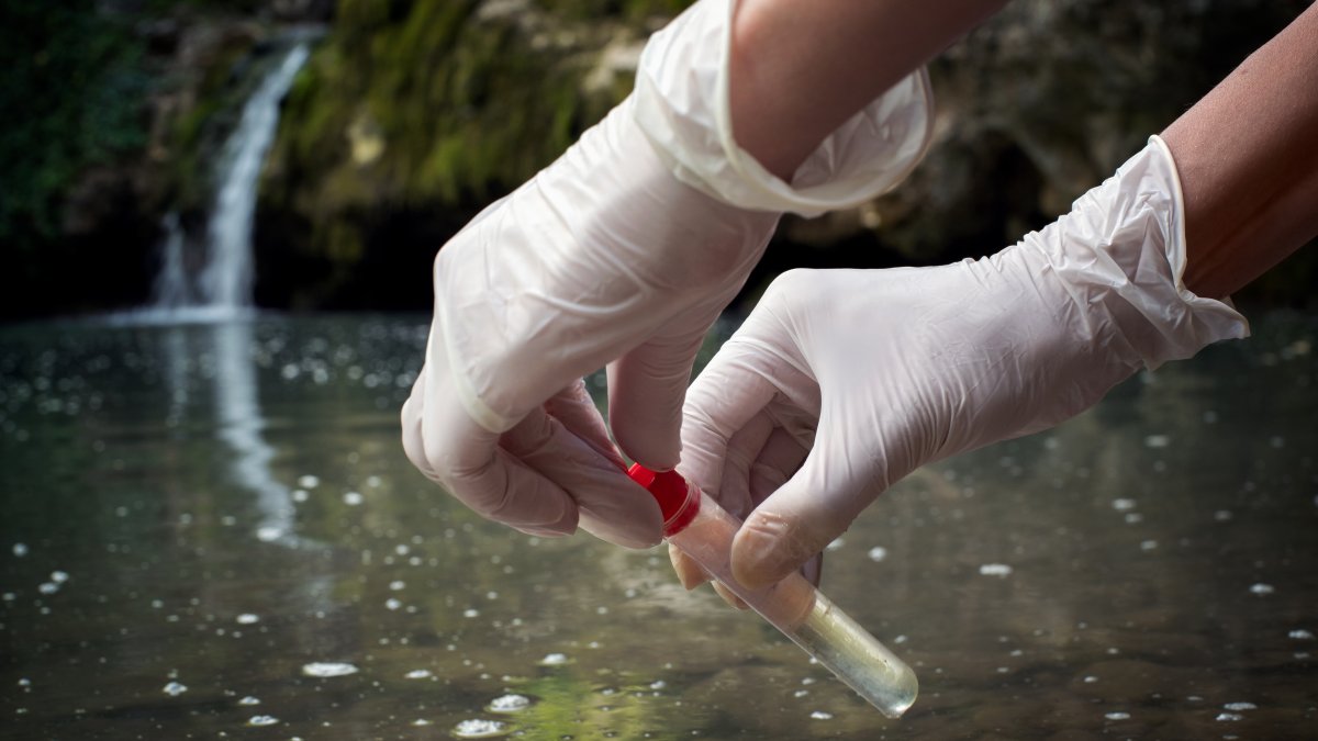 What you need to know about flesh-eating bacteria – NBC New York