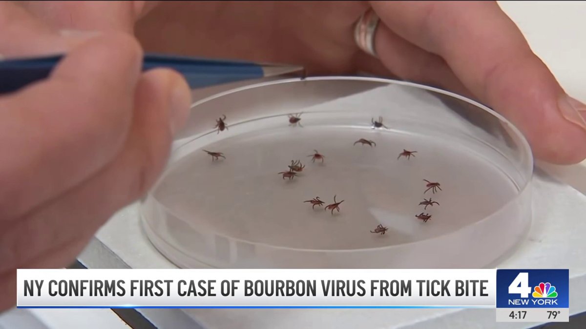 New York confirms first case of Bourbon Virus from tick bite – NBC New York